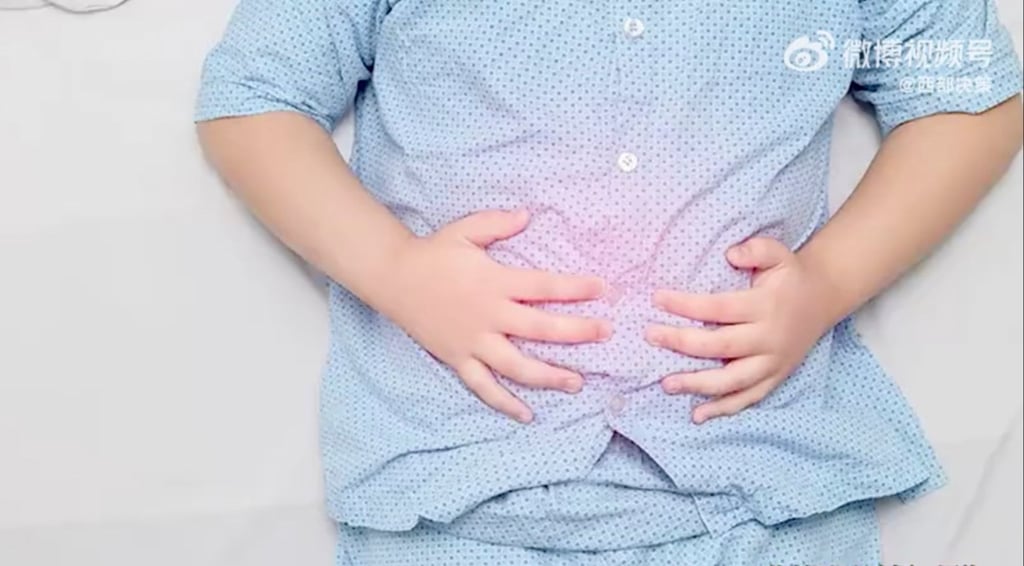 Toy beads puncture girl’s intestine: Chinese surgeons remove 61 ...