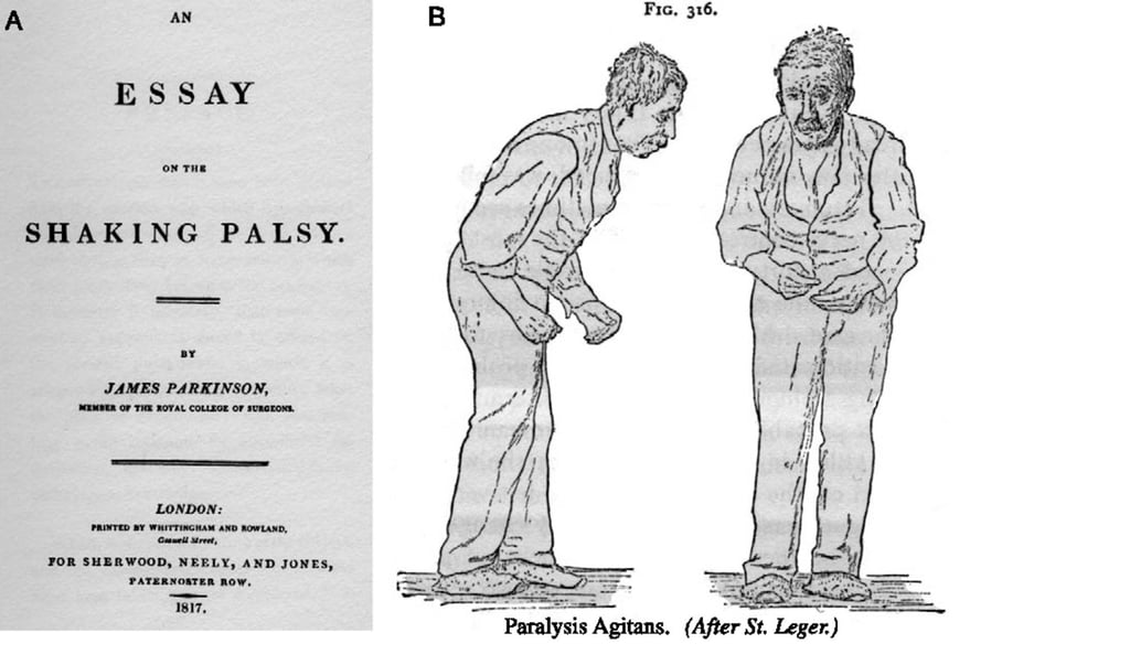 Explainer | What is Parkinson’s disease? Symptoms, possible causes ...