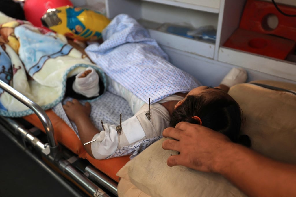 First group of wounded Palestinian children from Israel-Gaza war ...