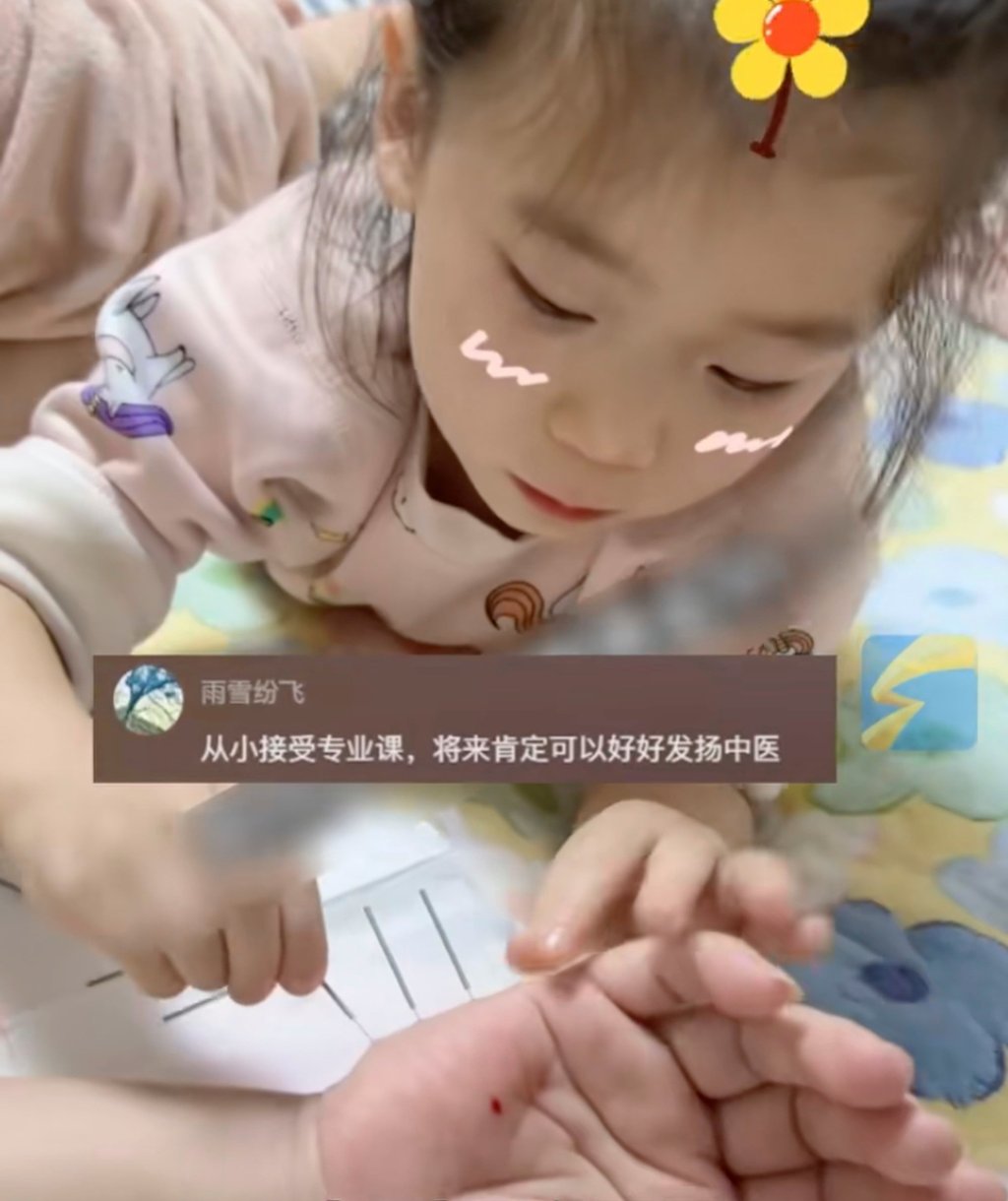 Video of China girl, 5, inserting acupuncture needles into hand under ...
