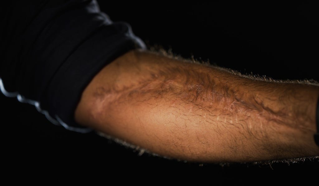 ‘I preferred animal underdogs’: the snake expert helping Nat Geo bust ...