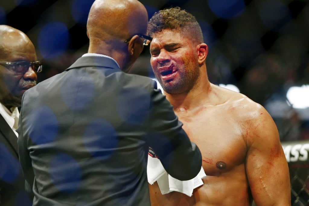 ufc overeem lip