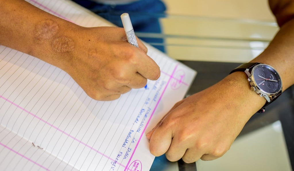 Indian doctors puzzle over amputee’s transplanted hands that adapted to ...