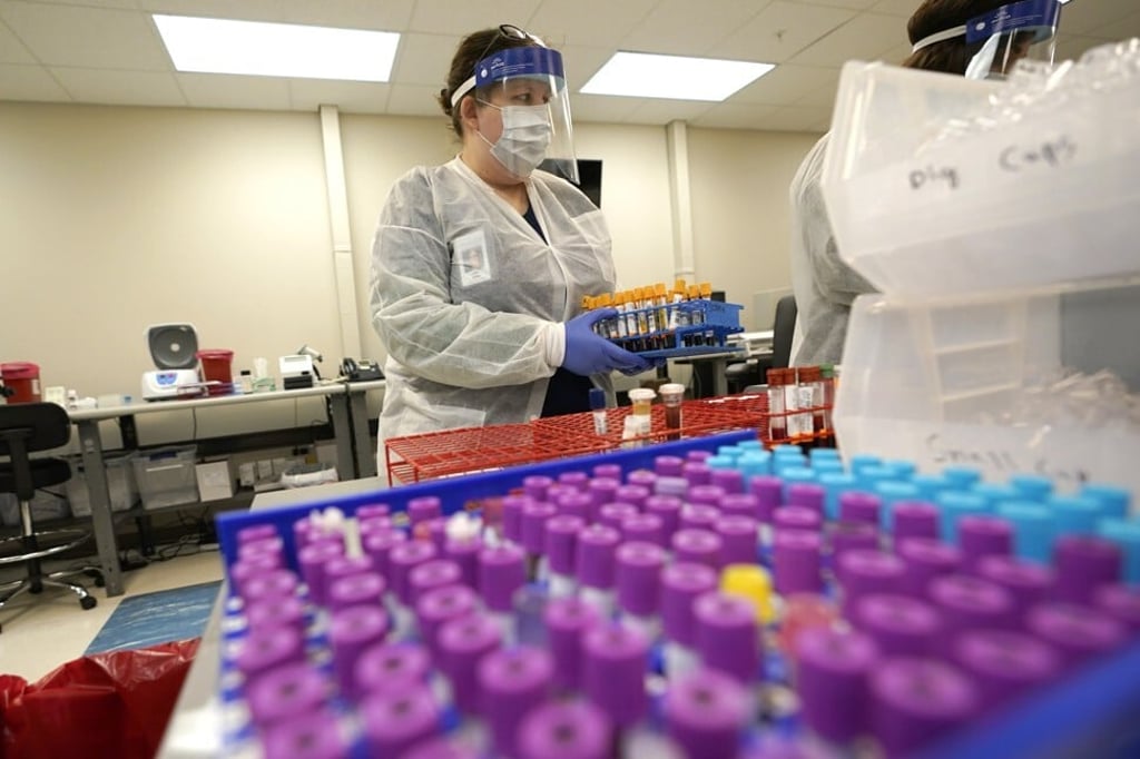 Researchers report more people with Covid-19 antibodies – and it’s ...