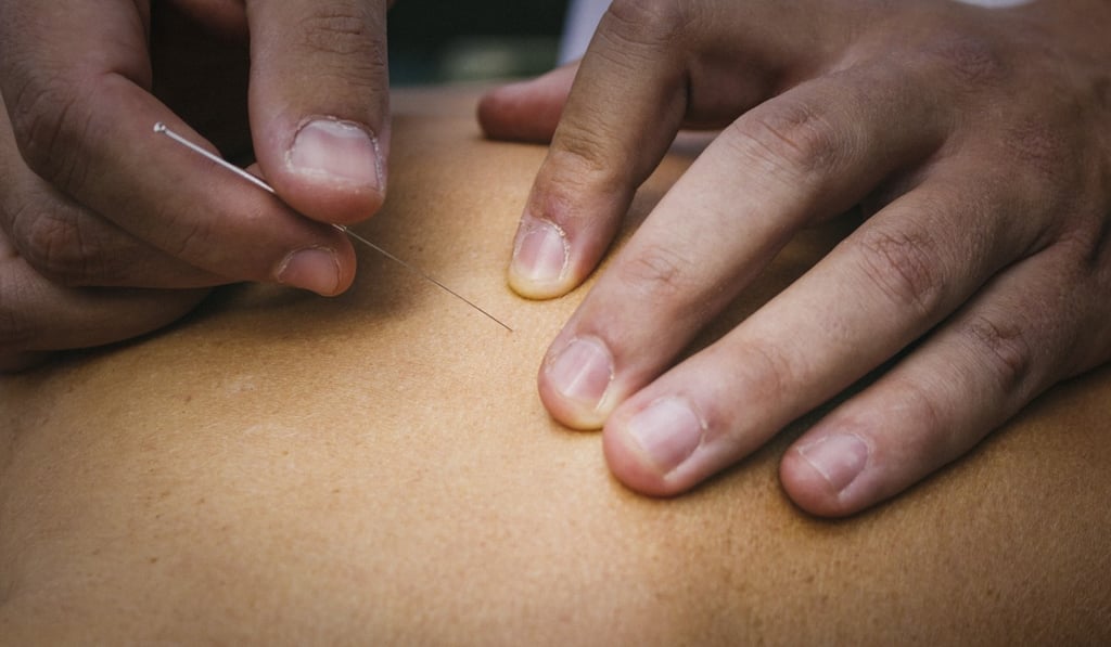 Hong Kong student left injured after Shenzhen acupuncture from ...