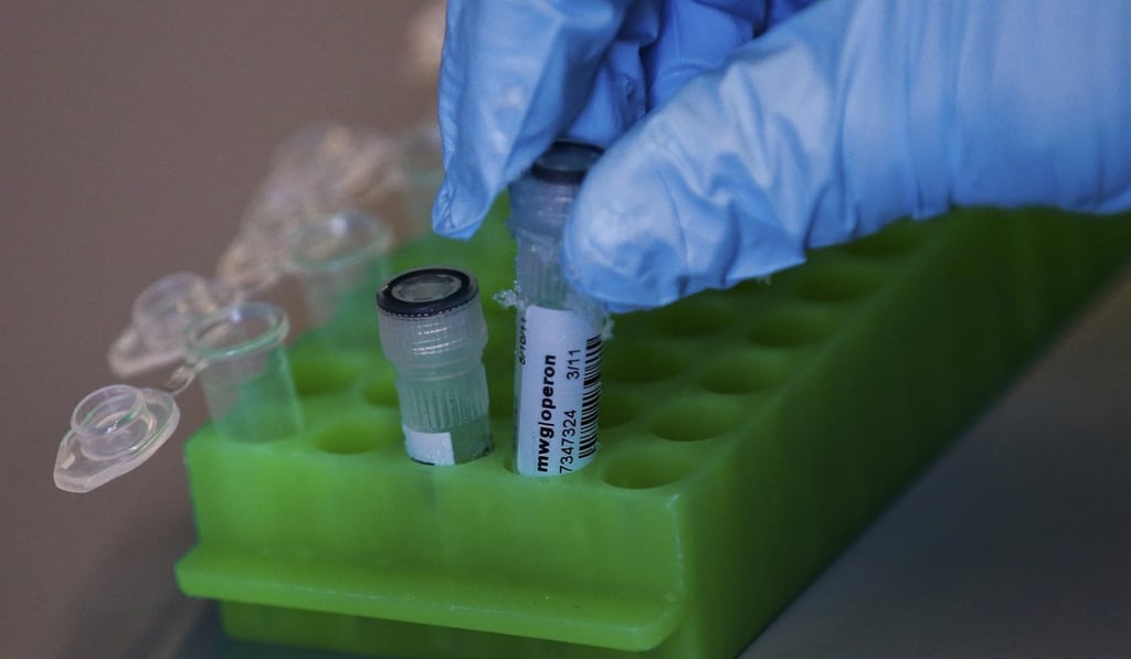 US scientists turn off cholesterol-linked gene, opening the way to ...