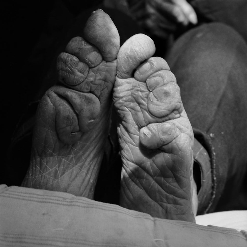 do chinese still do foot binding