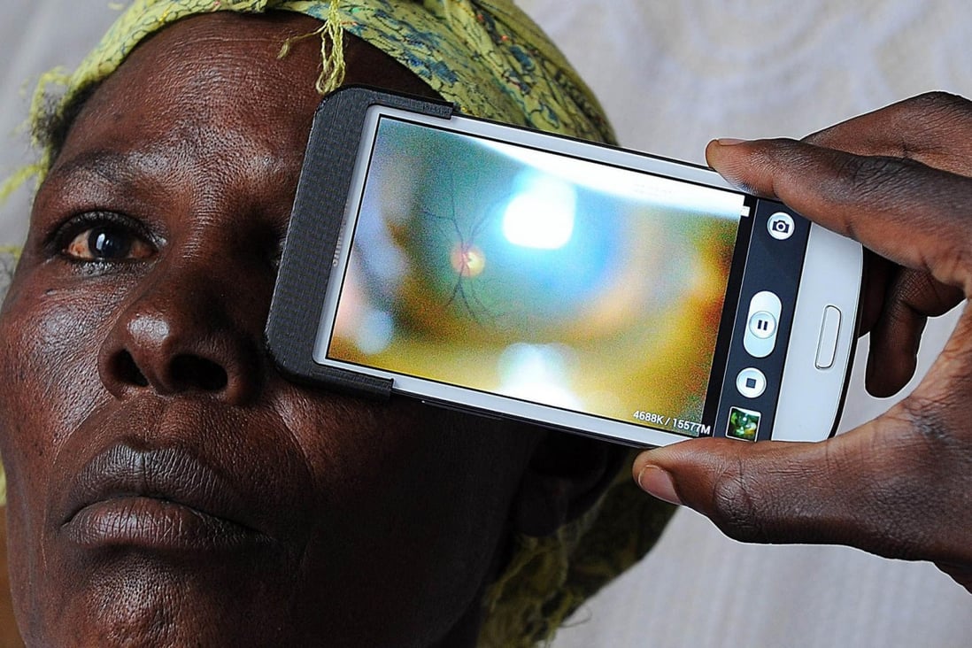 'Eye-Phone' a low-cost solution to save the sight of people in world's ...