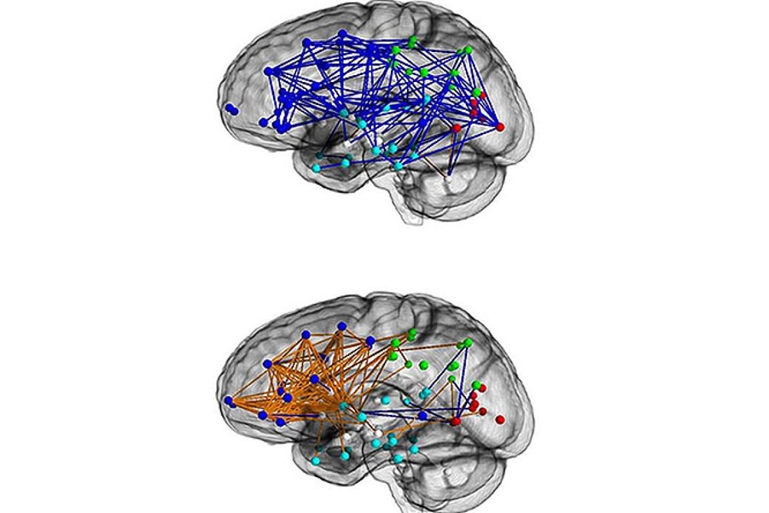 Brain maps confirm stereotypes about men and women, says scientists ...