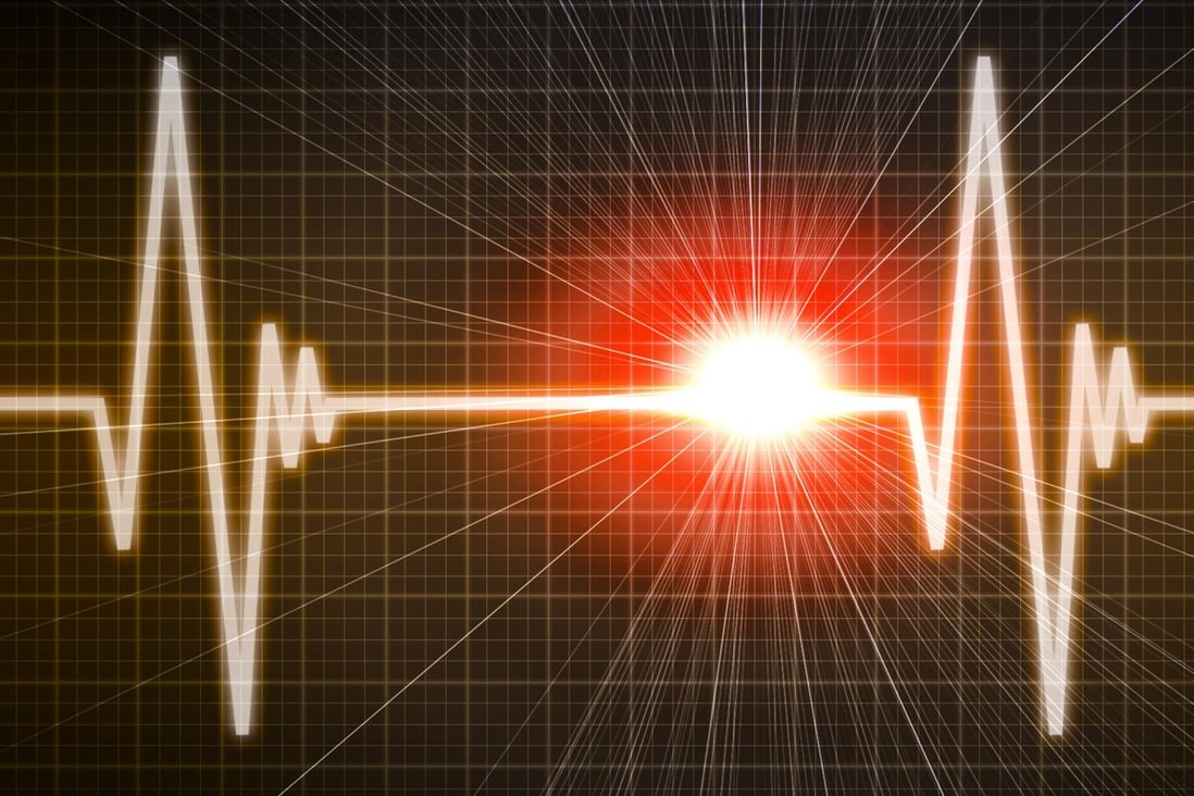 New defibrillator can be implanted without putting electrodes into ...