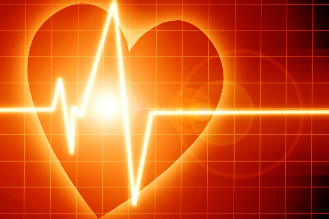 hits-myths-heart-attack-symptoms-don-t-always-include-chest-pain