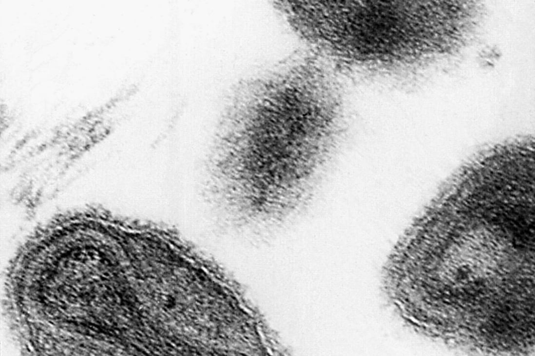 Alert after smallpox samples found in US laboratory storeroom | South ...