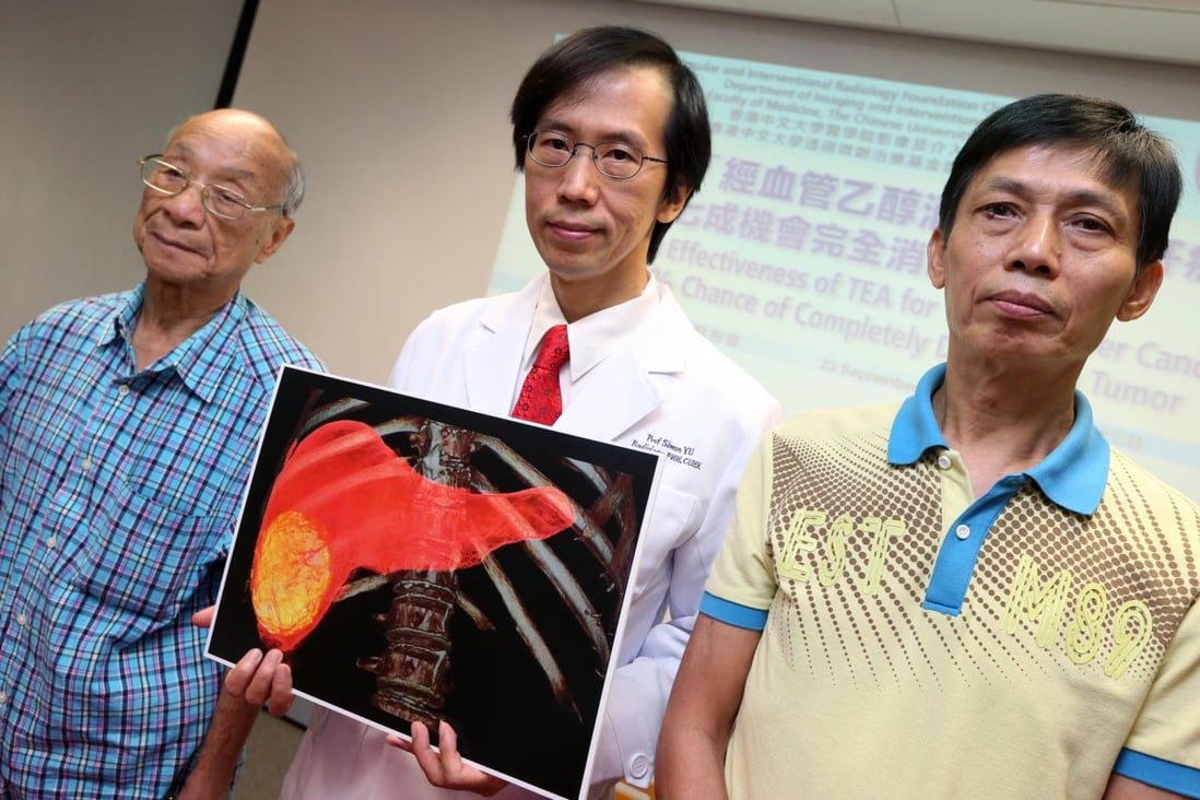 New treatment gives liver patients hope | South China Morning Post
