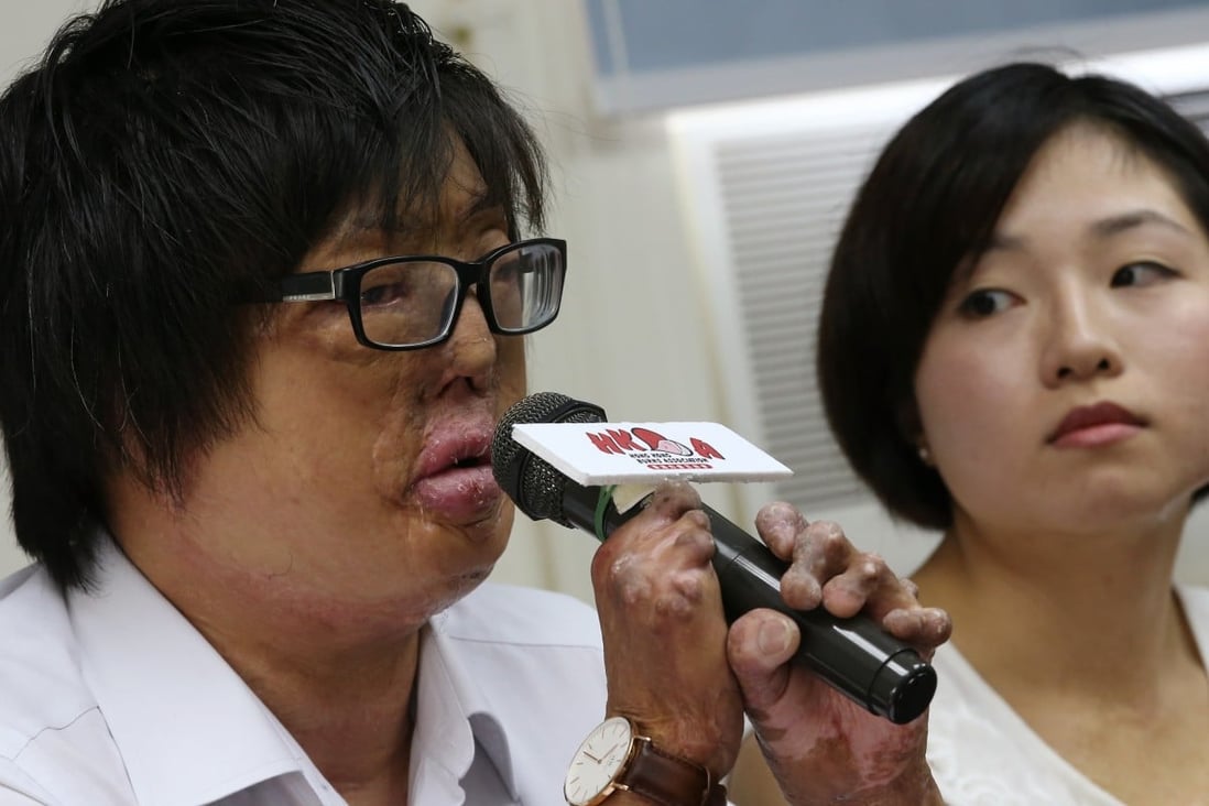 Hong Kong burns agency executive steps down over Taipei fireball ...