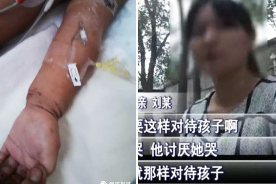 Chinese girl, 2, in coma with brain damage after vicious beating by ...