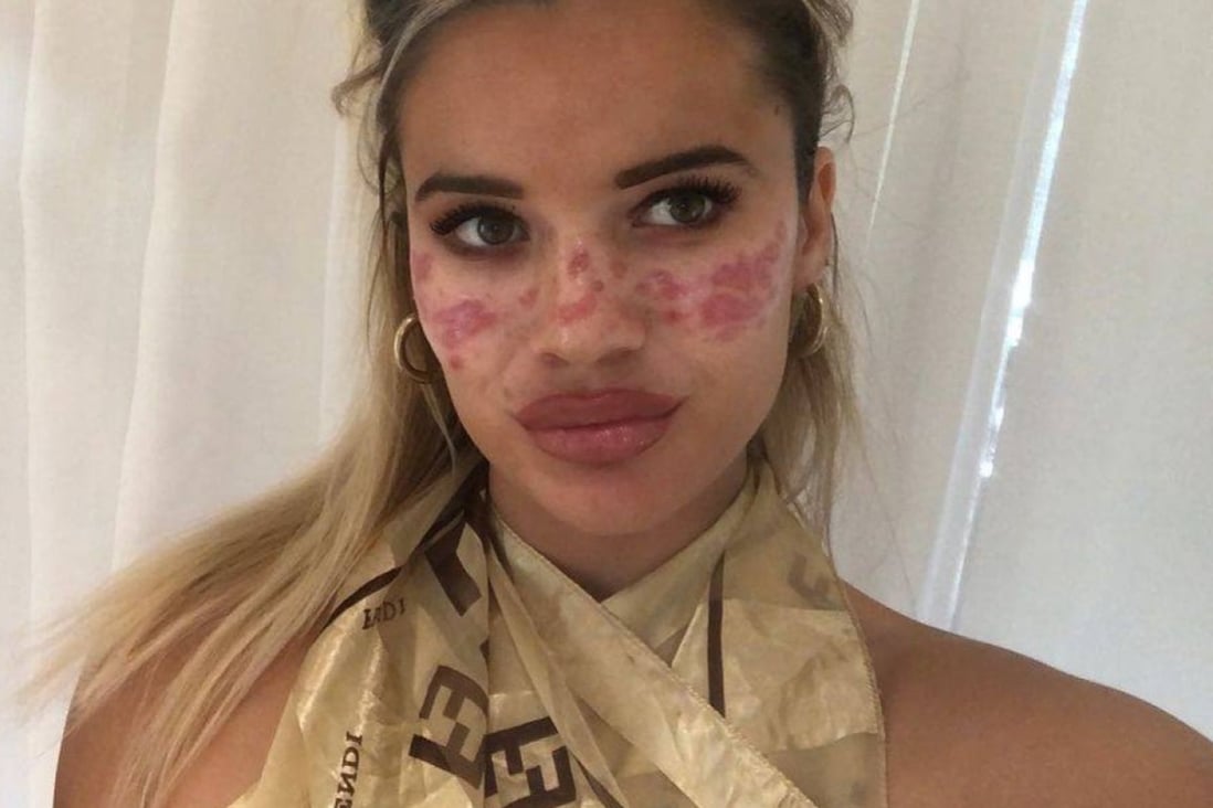 The Worst Viral Beauty Trends On Tiktok And Why You Should Avoid Them