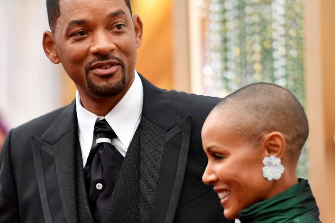 Alopecia areata, Jada Pinkett Smith’s hair-loss condition, now ...
