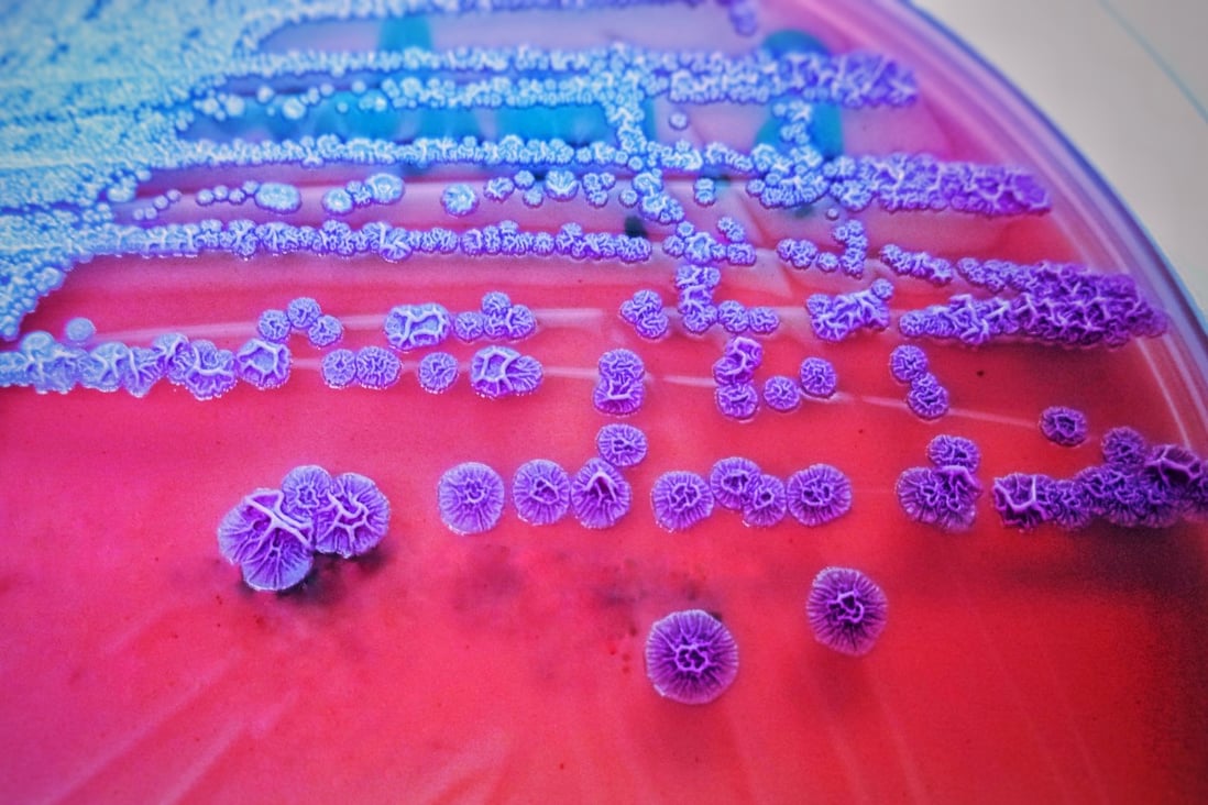 Hong Kong logs ‘abnormal’ spate of melioidosis cases, but experts say ...