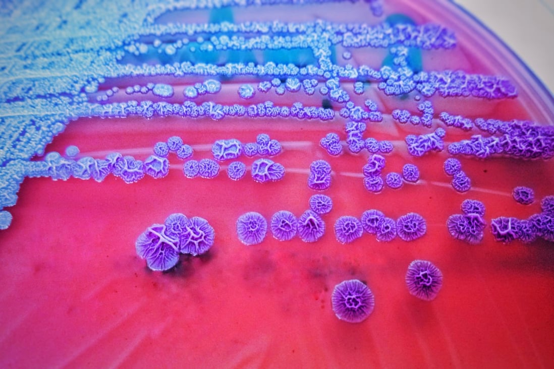 Melioidosis outbreak in Hong Kong may have originated at reservoir in ...