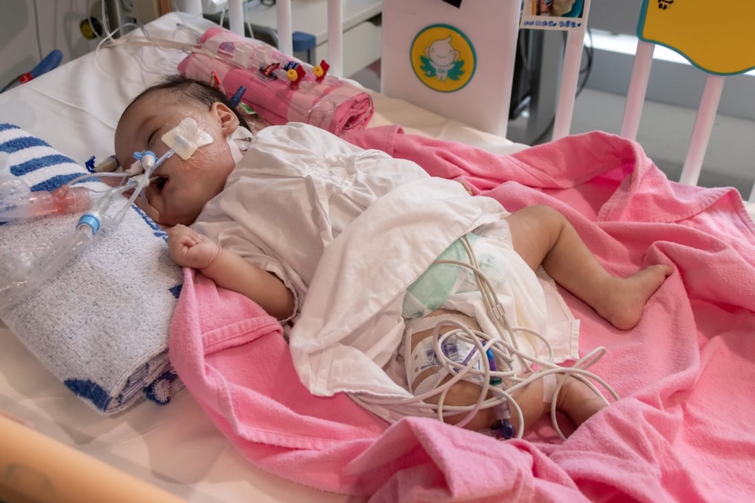 Hong Kong baby Cleo breathing unaided 2 months after city’s first organ ... Hong Kong baby Cleo breathing unaided 2 months after city’s first organ ...