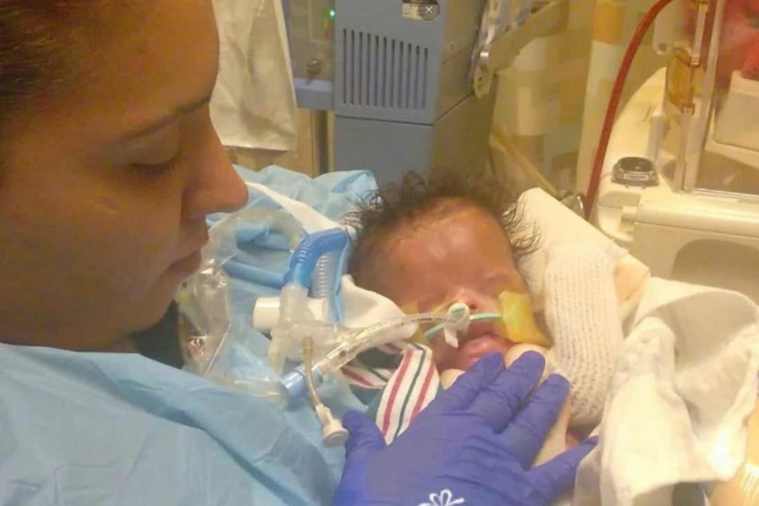 US baby Ja’bari was born with nearly no skin. Now doctors are fighting ...