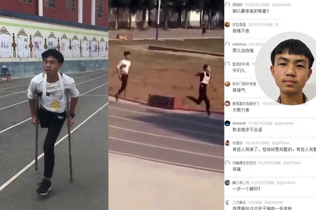 One-legged Chinese student wins hearts of schoolmates and nation after ...