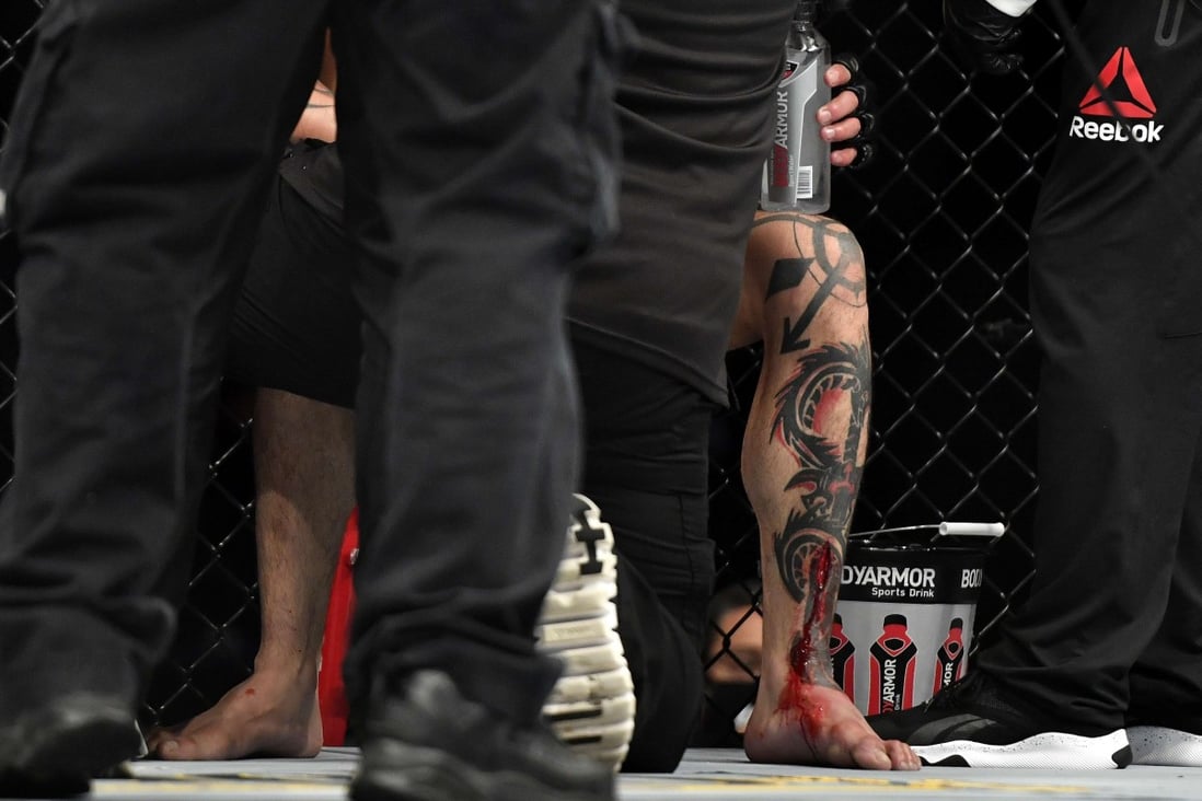 UFC: Gabriel Benitez suffers horrendous shin gash in decision loss ...