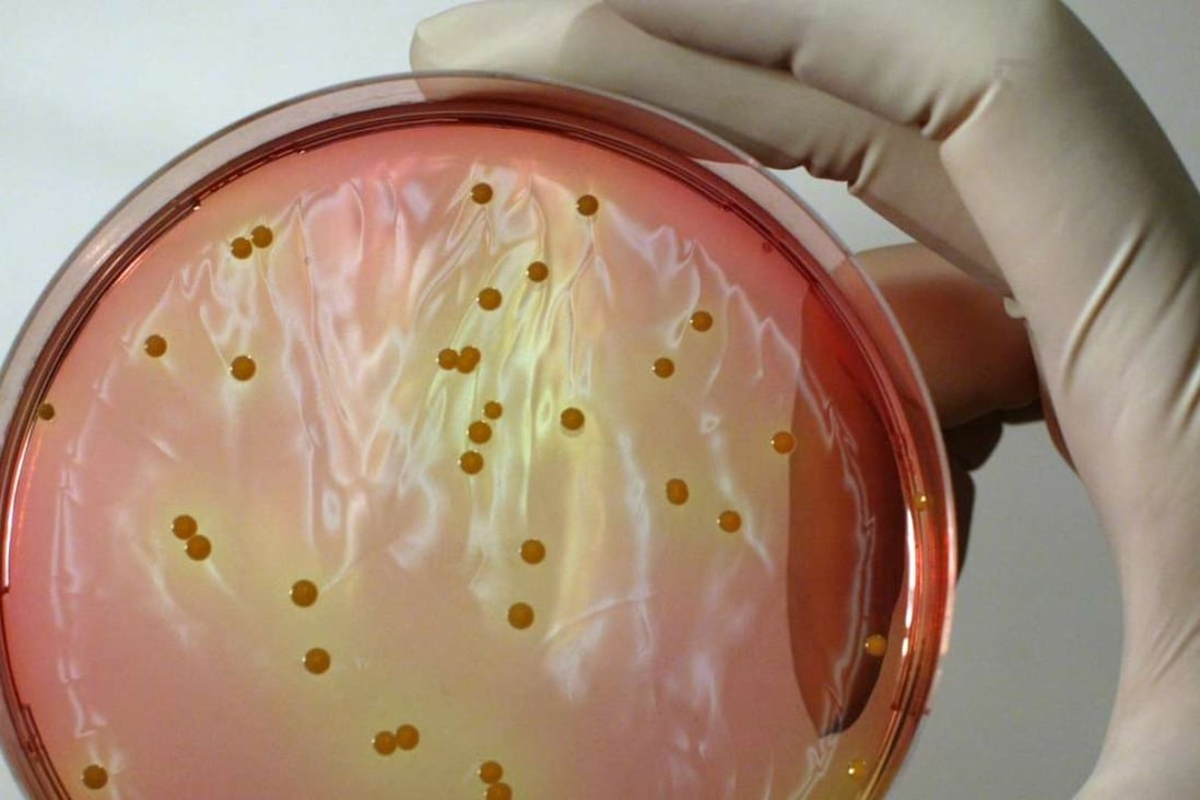 6 things you should know about the Staphylococcus bacteria, a potential ...
