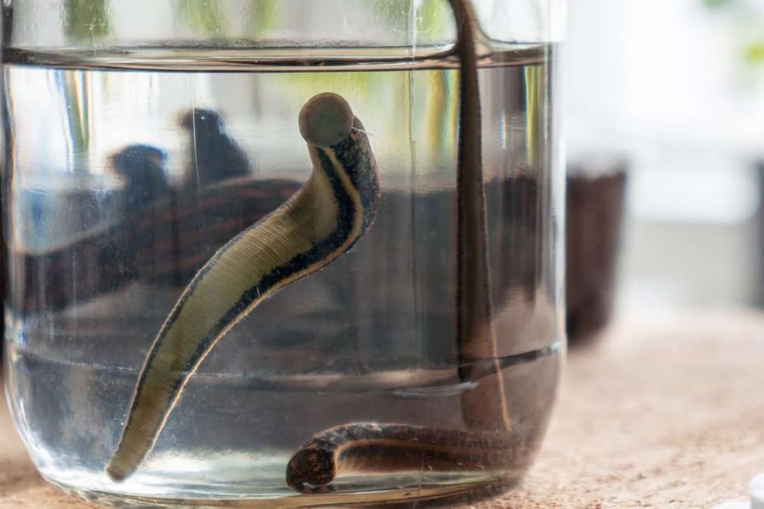 Chinese woman’s ‘bloodthirsty’ hobby of keeping leeches as pets not ...