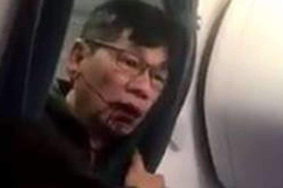 United passenger David Dao breaks silence, saying he’s still in the hospital and ‘everything’ is ...