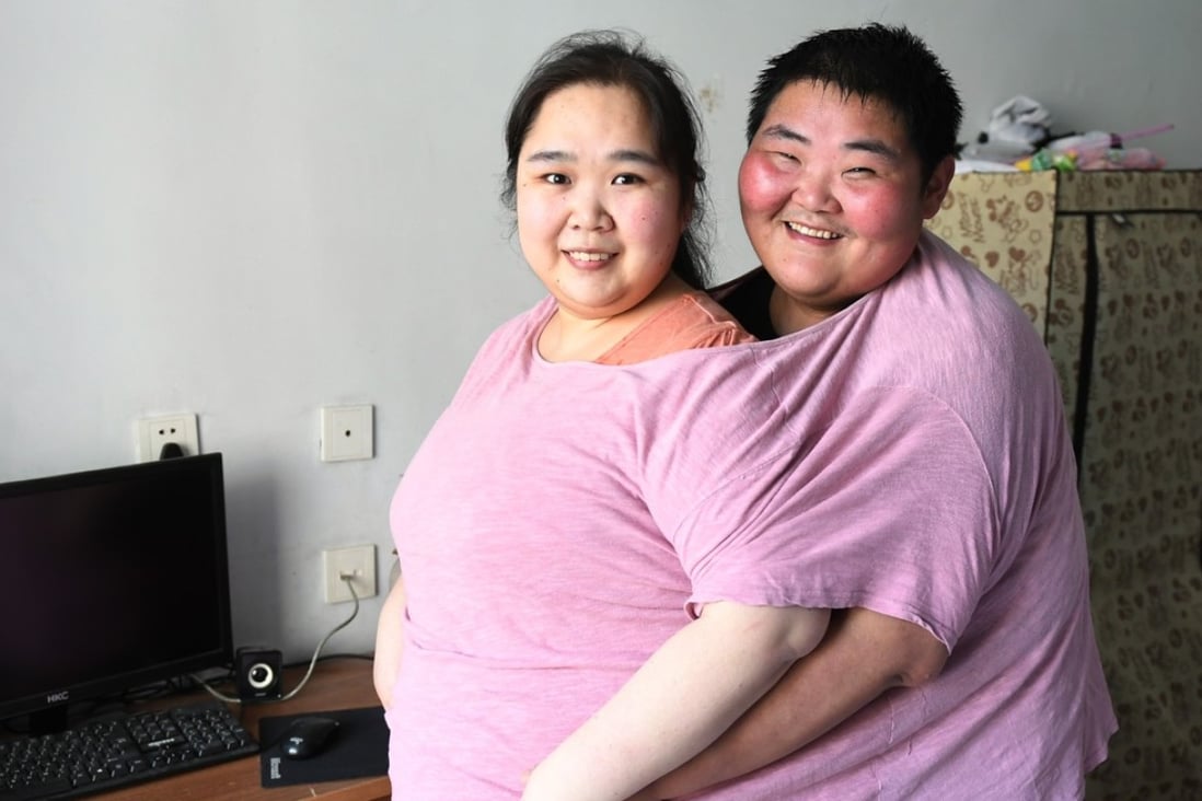 Morbidly obese Chinese couple loses 200kg between them so they can ...