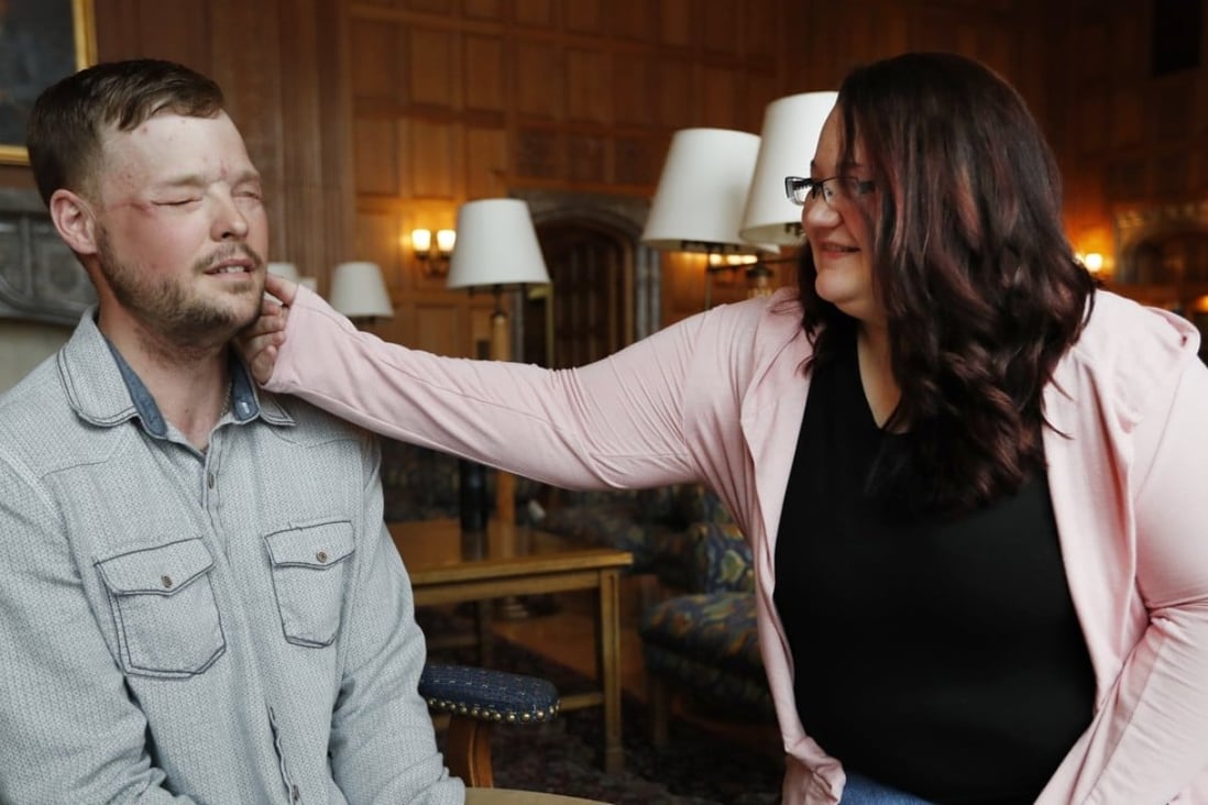 The moment a widow touched the face that once belonged to husband who ...