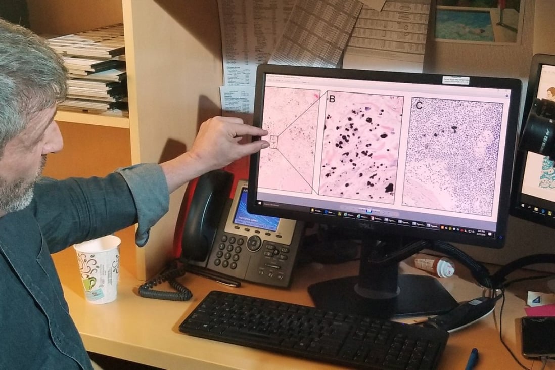 The interstitium is a newly discovered part of the human anatomy and it ...