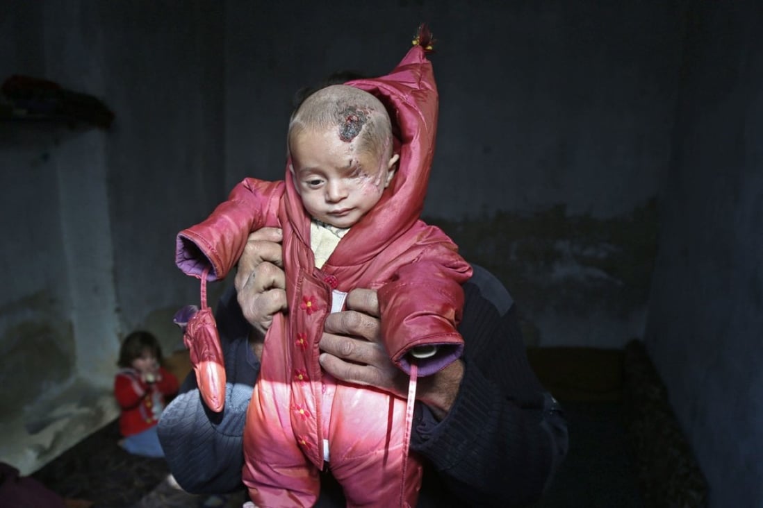 One-eyed Syrian baby whose plight set off viral campaign online arrives ...