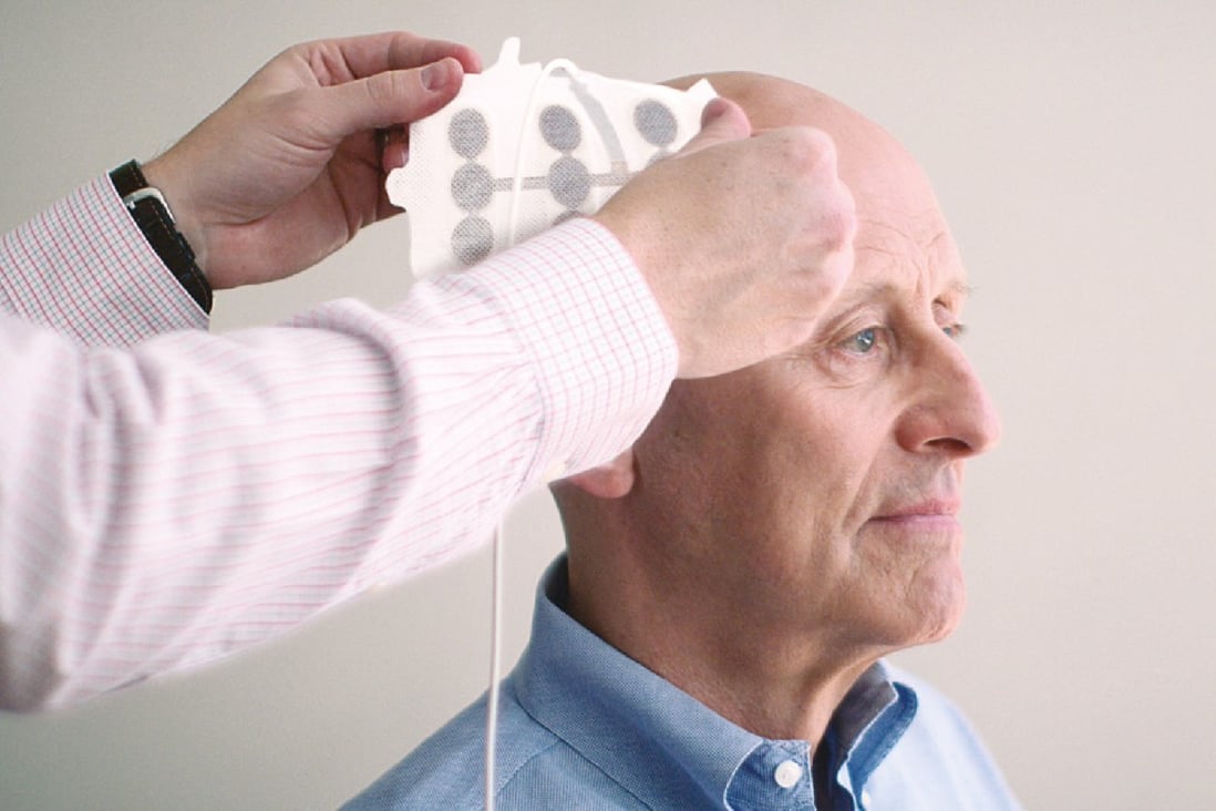 Cancer therapy that fights brain tumours with electric fields brings ...