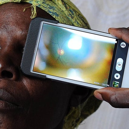 'Eye-Phone' a low-cost solution to save the sight of people in world's ...