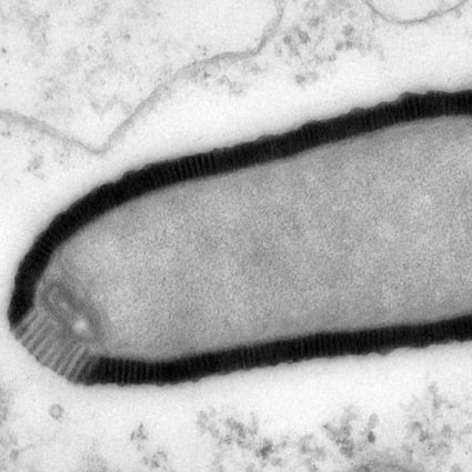 Mega virus revived from Siberian ice after 30,000 years chills ...