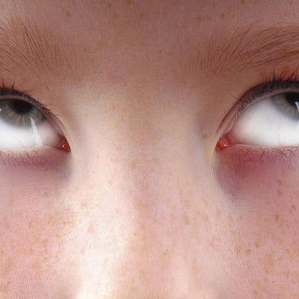 How to react when teenagers roll their eyes at something you say or do ...