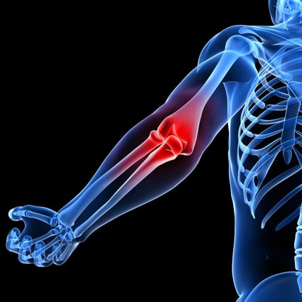 Facts about the elbow: how to avoid tennis elbow, why it’s called the ...