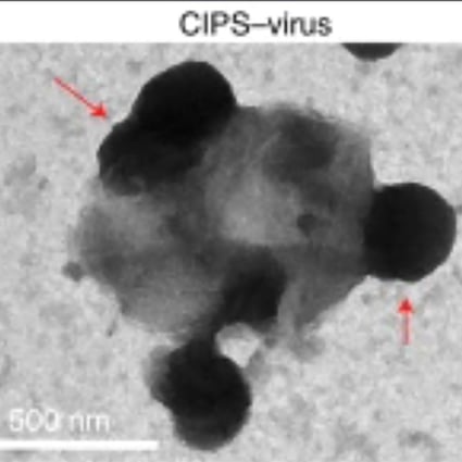 Tiny discovery in Chinese lab could be a big deal in stopping Covid-19 ...