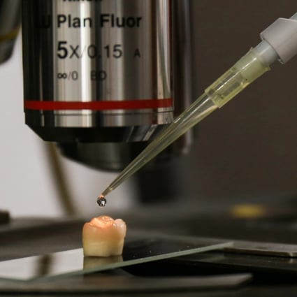 Chinese scientists ‘make first perfect replica’ of tooth enamel | South ...