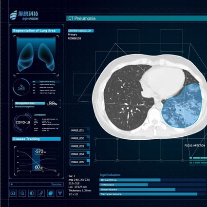 Chinese medical imaging start-up faces twin hurdles in US market for ...