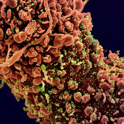 Research finds coronavirus in stool samples 22 days after onset of ...