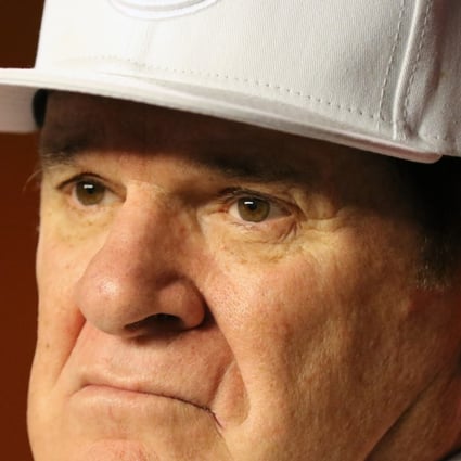 baseball-s-sanctimony-means-hit-king-pete-rose-will-continue-to-suffer