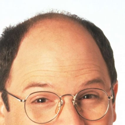 Short, white men are more likely to go bald, study finds | South China ...