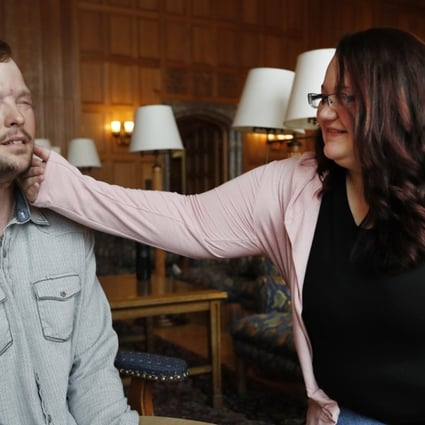 The moment a widow touched the face that once belonged to husband who ...