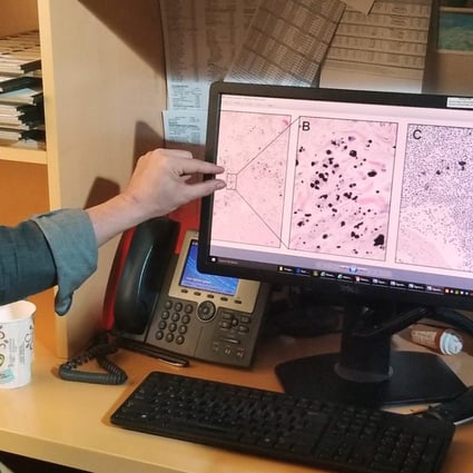 The interstitium is a newly discovered part of the human anatomy and it ...